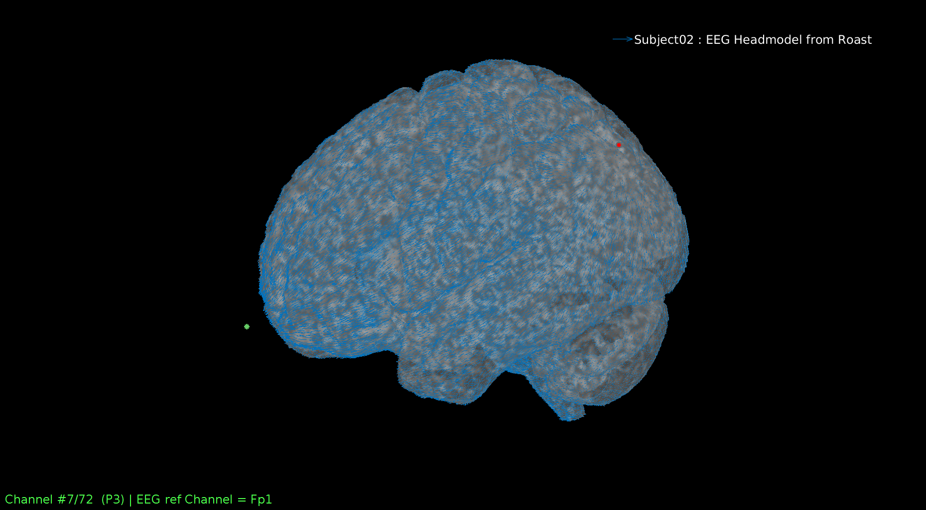 Loading Roast Outputs to Brainstorm · Issue #25 · andypotatohy/roast ...