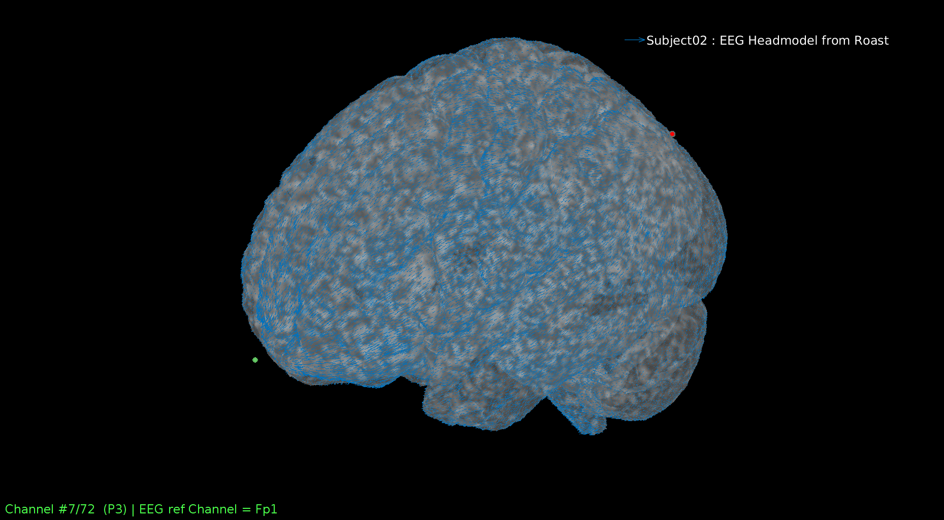 Loading Roast Outputs to Brainstorm · Issue #25 · andypotatohy/roast ...
