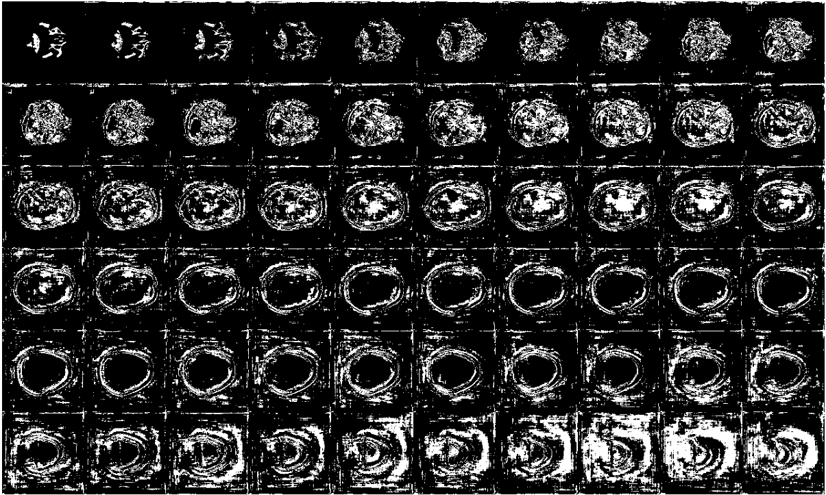 GitHub - JonathanKeav/autoimplant-project