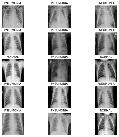 GitHub - jshah13/Pneumonia-Classification: TensorFlow Pneumonia ...