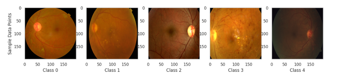 GitHub - wisnu45/KLASIFIKASI-DIABETIC-RETINOPATHY: KLASIFIKASI DIABETIC RETINOPATHY MENGGUNAKAN ...