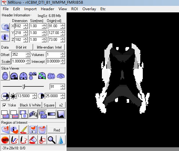 How to choose antsApplyTransforms interpolation? · Issue #677 · ANTsX/ANTs · GitHub