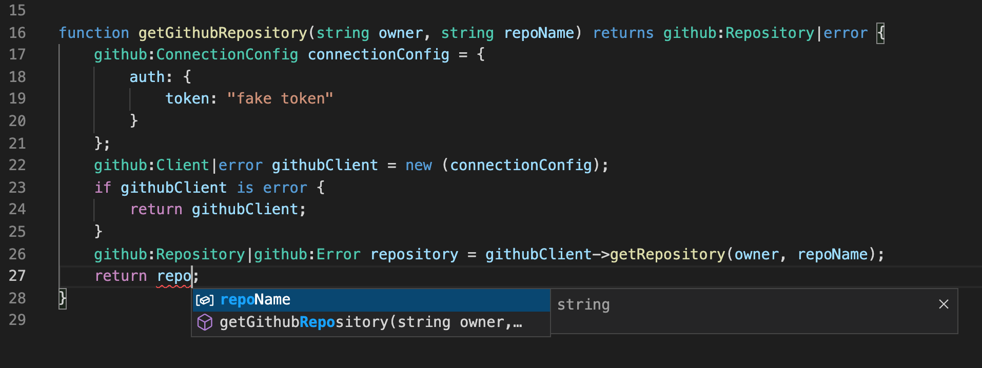Missing variable completion · Issue #159 · wso2/ballerina-vscode · GitHub