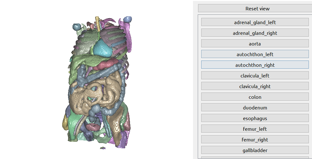GitHub - abstrackt/Thesis-Project: DL segmentation of medical data ...
