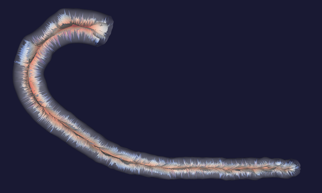 GitHub - abstrackt/Thesis-Project: DL segmentation of medical data, mesh generation and ...