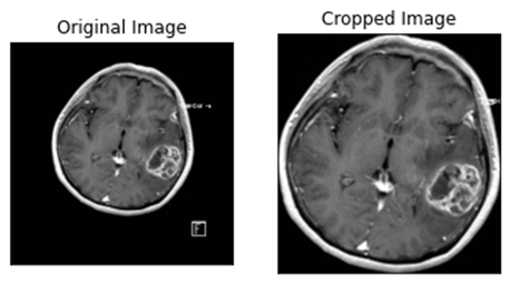 GitHub - bhumikasharma29/Brain-Tumor-Detection-CNN: Brain Tumor ...