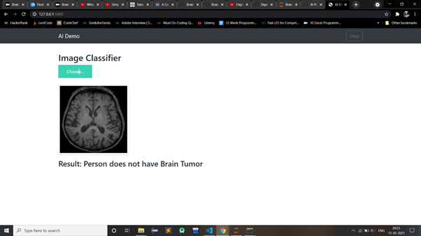 GitHub - bhumikasharma29/Brain-Tumor-Detection-CNN: Brain Tumor ...