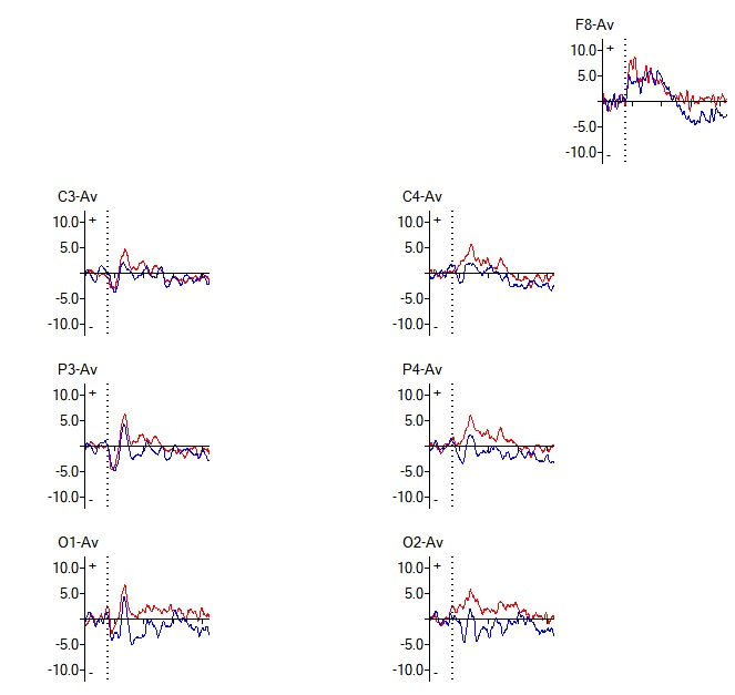 Discrepancy between ERP plots in ERPLAB and WinEEG · Issue #105 ...