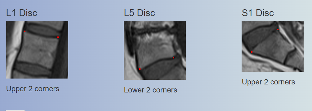 GitHub - Mehedi-909/lumbar-spine-disease-detector