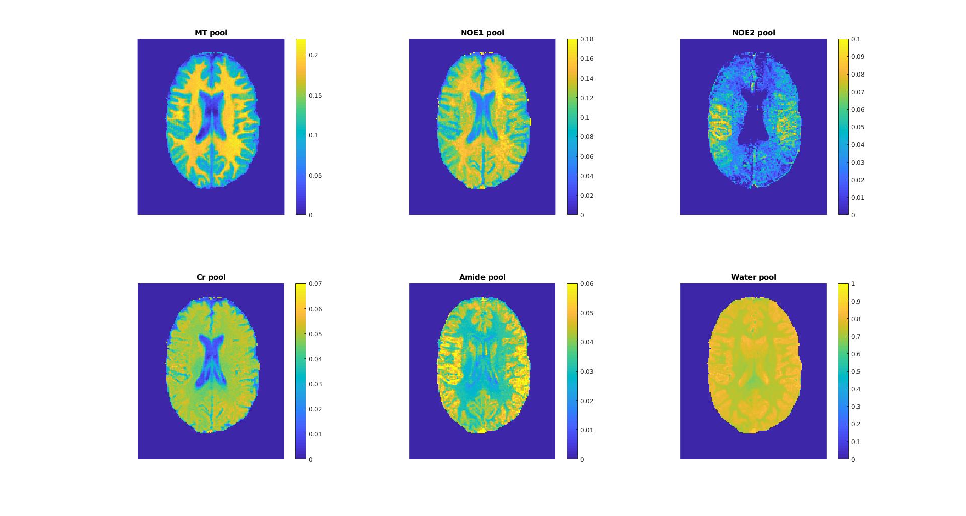 GitHub - almostdutch/CEST-7pool-LorentzianLineshapeModel-fitting-in-C ...