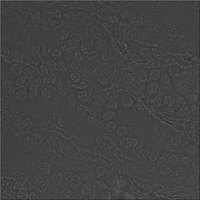 Wrong 3D Registration Output · Issue #318 · SuperElastix/SimpleElastix · GitHub