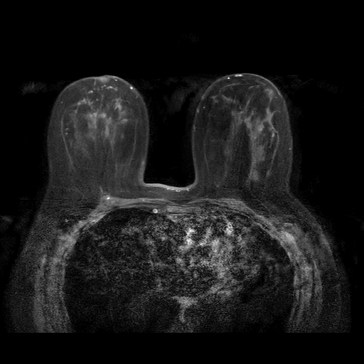 FOV and pixelspacing mismatch issue · Issue #576 · SimpleITK/SimpleITK ...