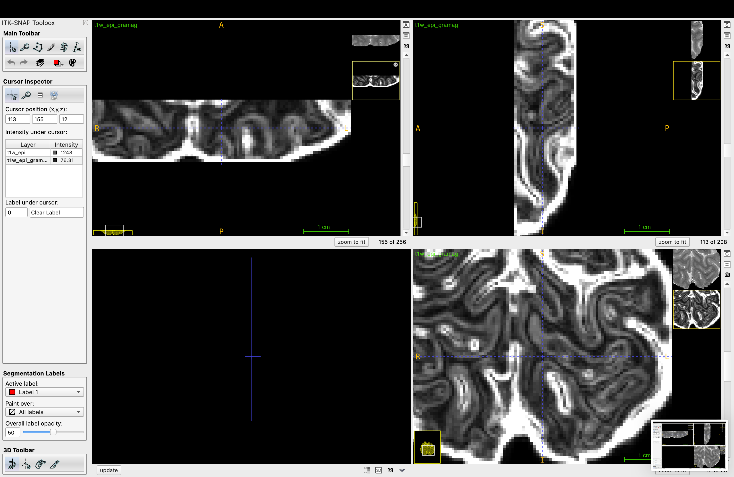LN2_GRAMAG returning all zeros when 'scl slope' nifti header is 0 ...