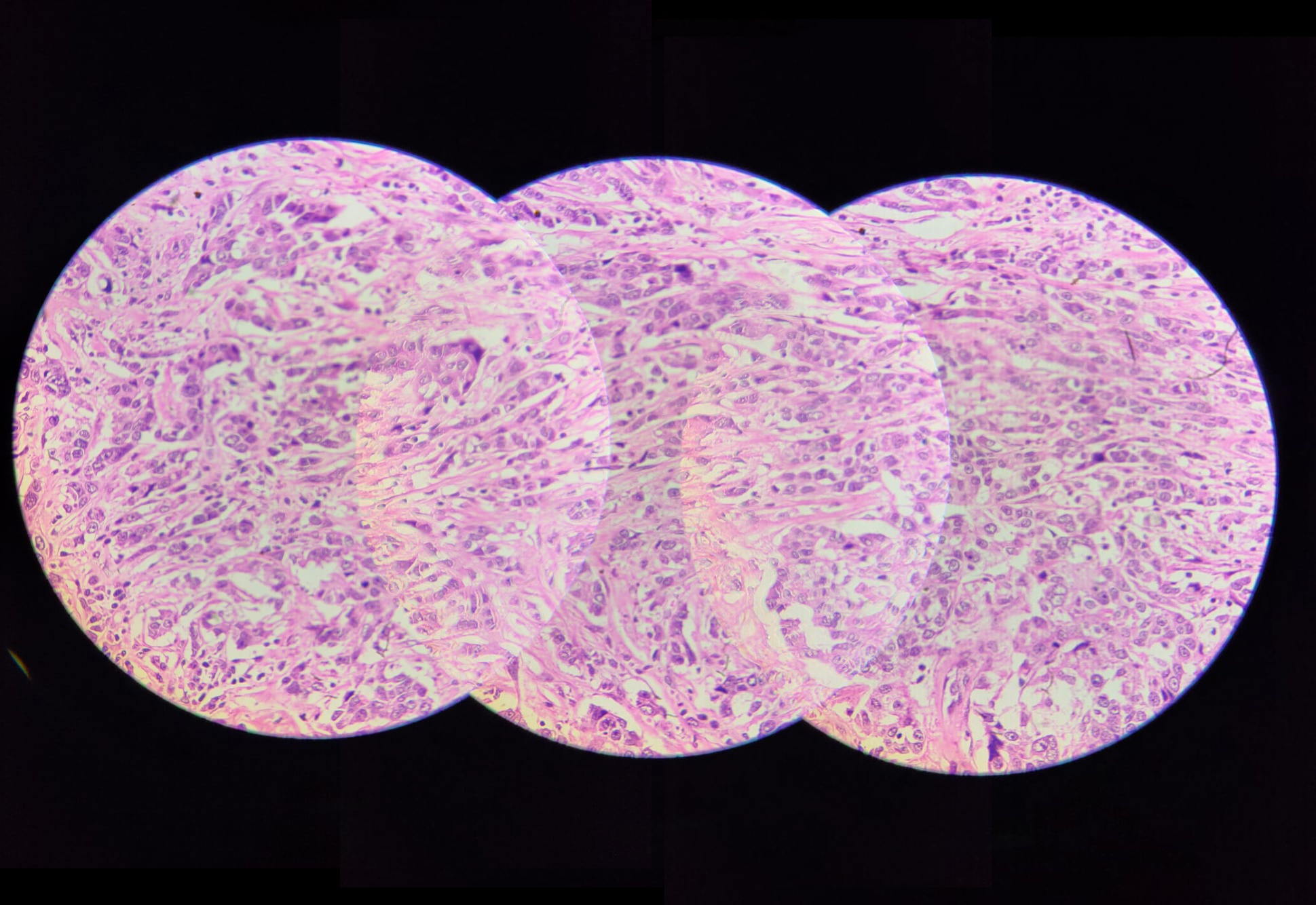 Output is not correct · Issue #7 · Keep-Passion/ImageStitch · GitHub