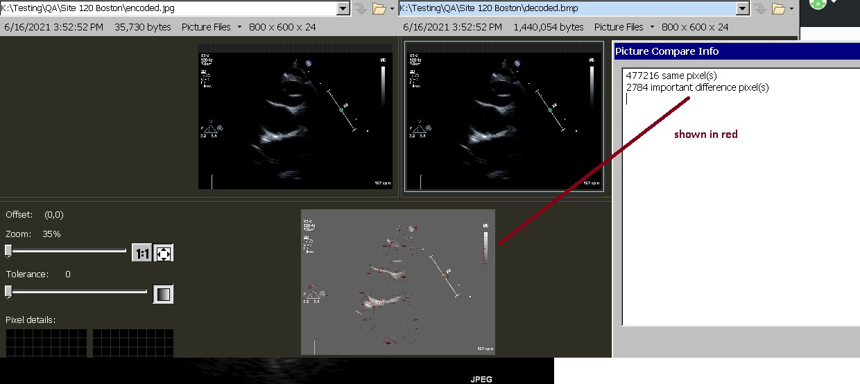 JPEG decoding differences · Issue #1188 · fo-dicom/fo-dicom · GitHub