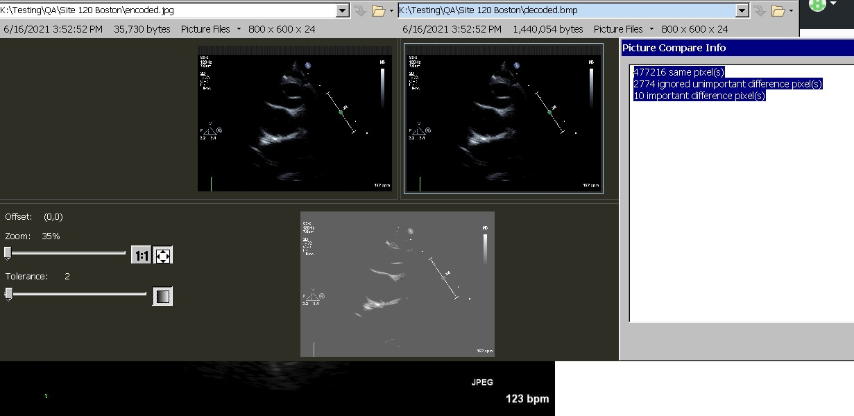Jpeg Decoding Differences · Issue 1188 · Fo Dicomfo Dicom · Github