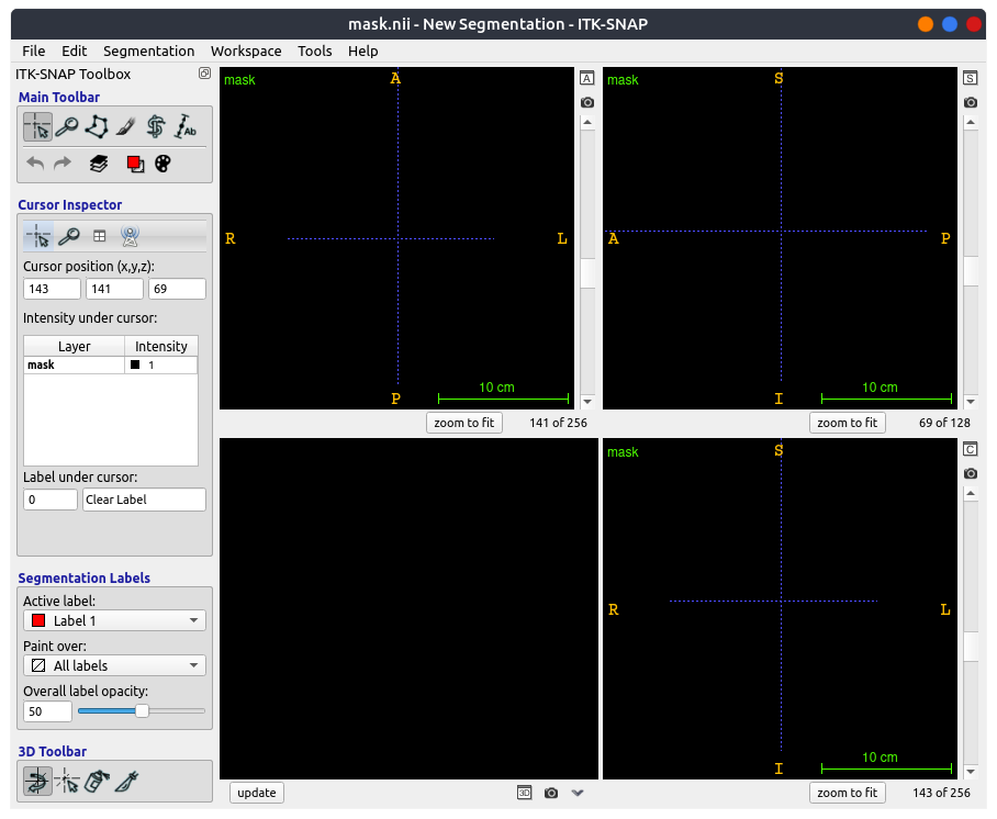 Issue with ants.threshold_image not returning binary mask · Issue #236 · ANTsX/ANTsPy · GitHub