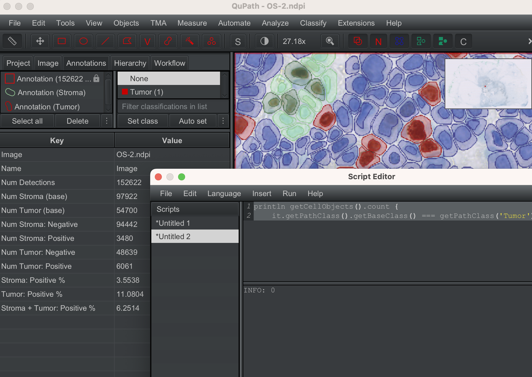 Derived Classifications Can Be Read Incorrectly From Data Files And Json · Issue 1306 · Qupath