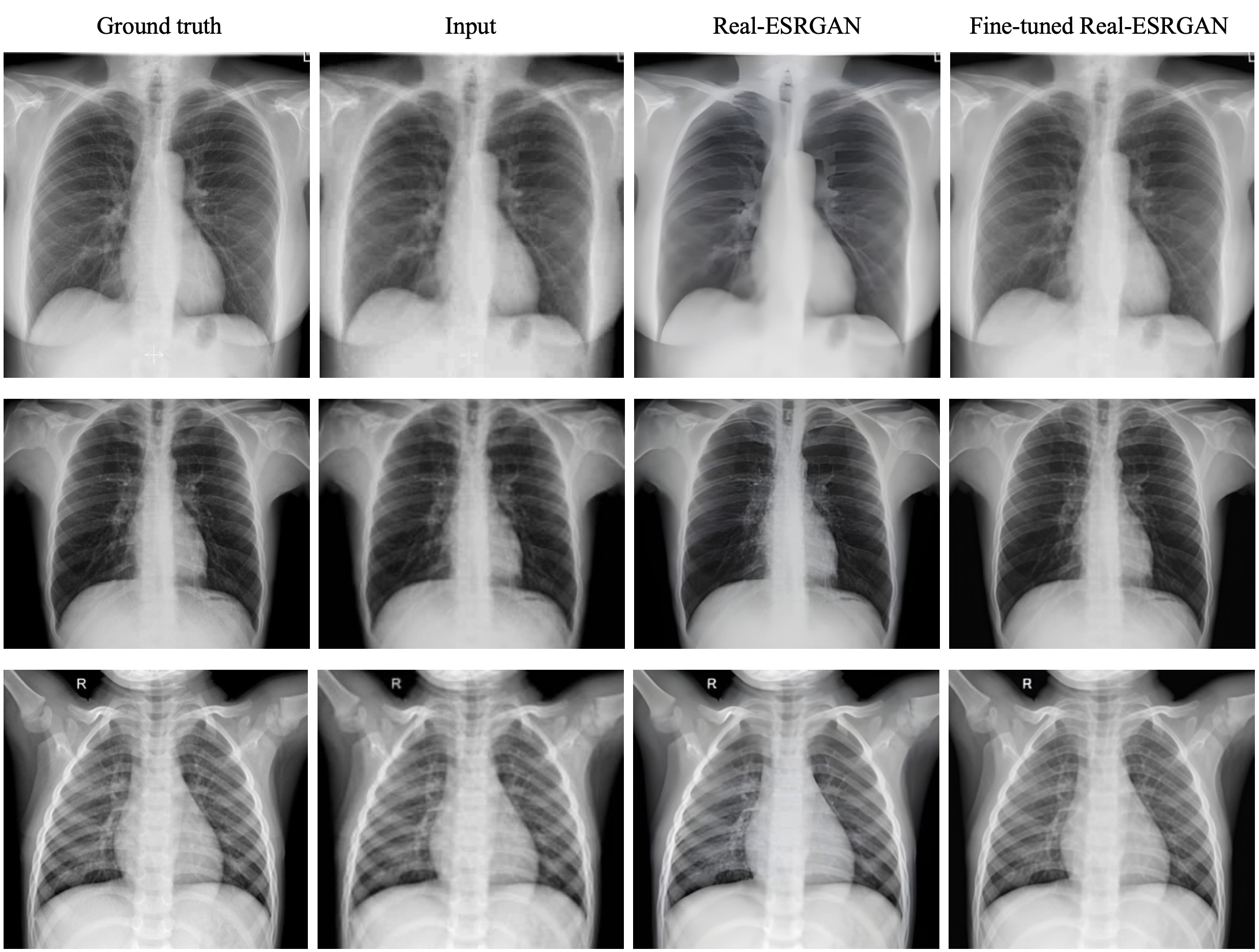 GitHub - alireza-aghelan/medical-image-super-resolution: Fine-tuned Real-ESRGAN model for ...
