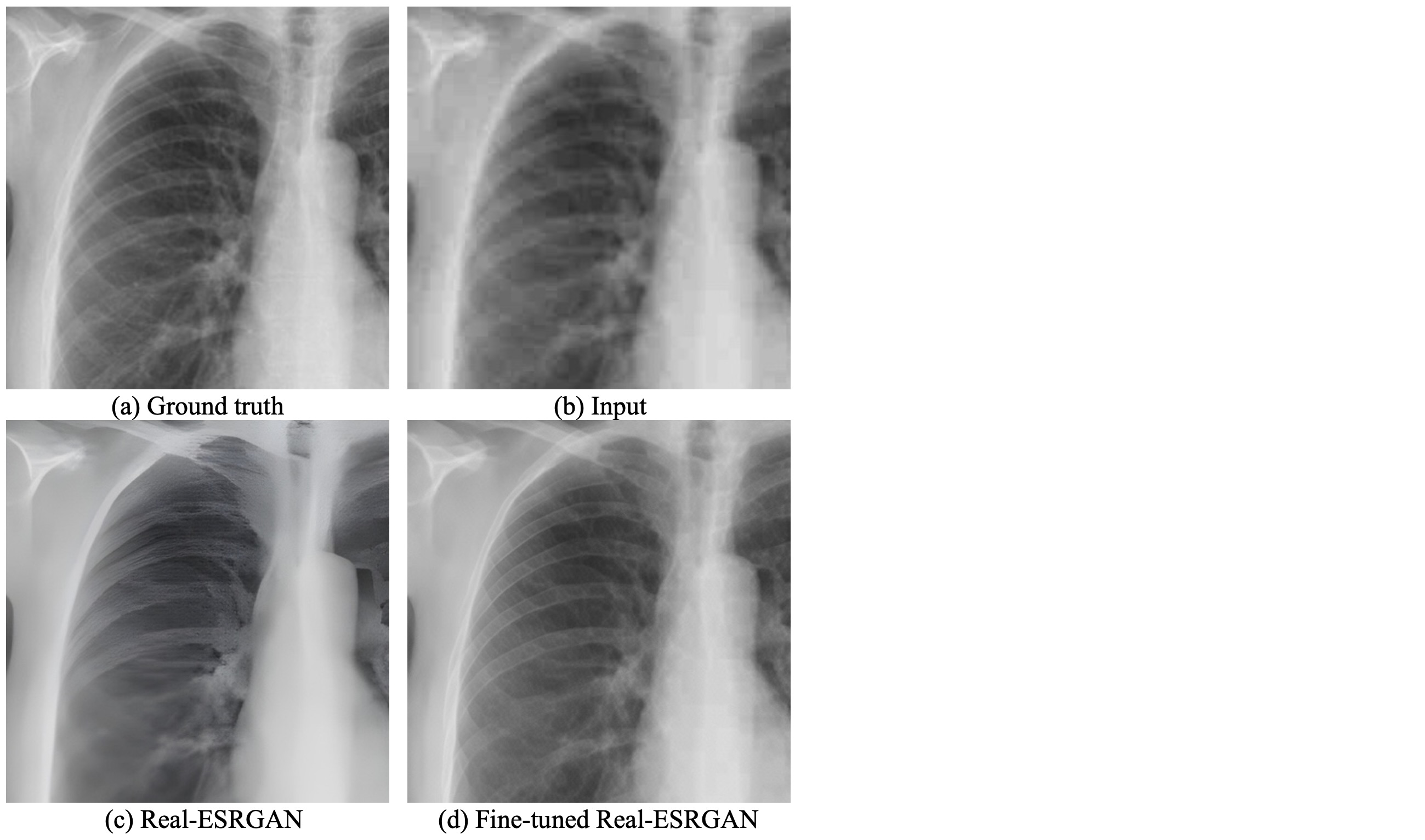 GitHub - alireza-aghelan/medical-image-super-resolution: Fine-tuned Real-ESRGAN model for ...