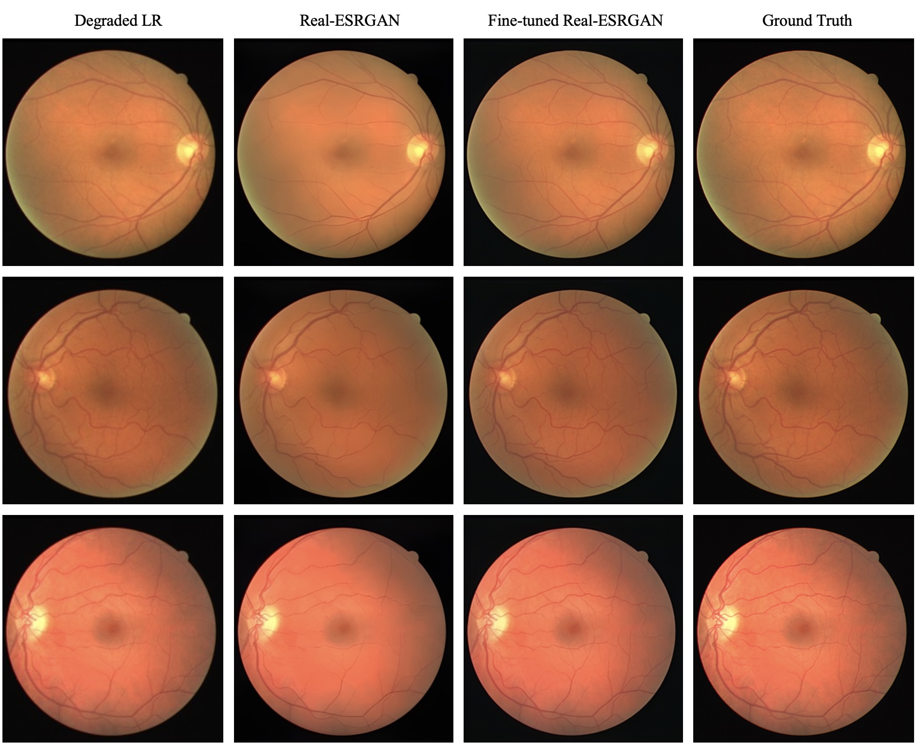 GitHub - alireza-aghelan/medical-image-super-resolution: Fine-tuned ...