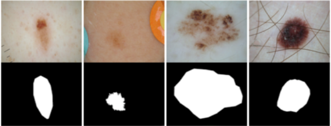 GitHub - Arshadfaizan/Skin-Cancer-Detection-Using-Semantic-Segmentation