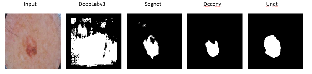 GitHub - Arshadfaizan/Skin-Cancer-Detection-Using-Semantic-Segmentation