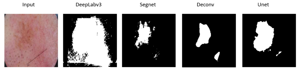 GitHub - Arshadfaizan/Skin-Cancer-Detection-Using-Semantic-Segmentation