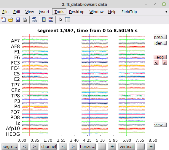 improve ft_databrowser for reviewing large amounts of trial-based data · Issue #1968 · fieldtrip ...
