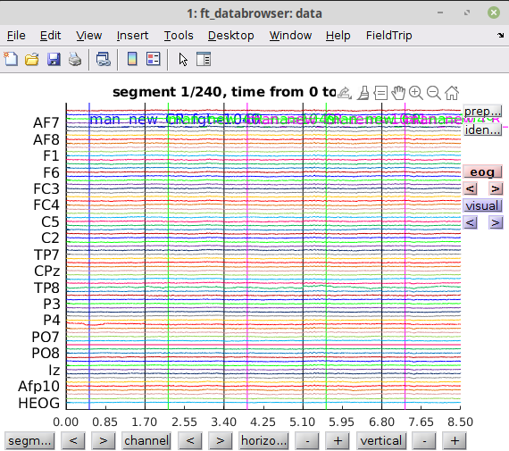 improve ft_databrowser for reviewing large amounts of trial-based data · Issue #1968 · fieldtrip ...