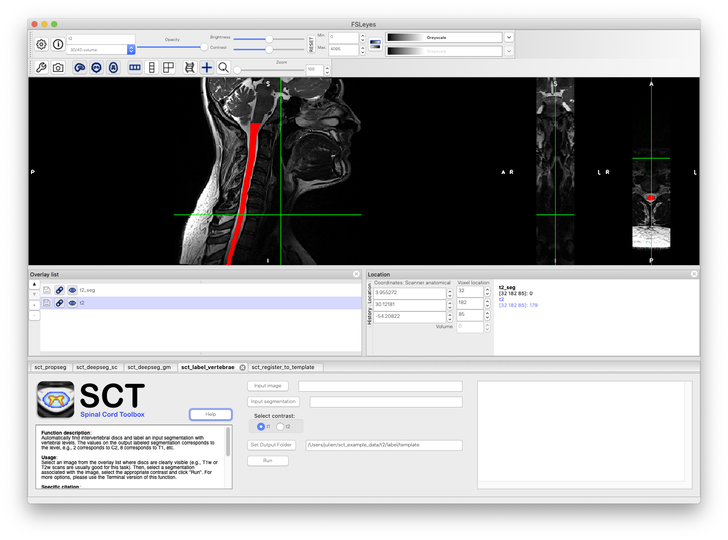 Consider using FSLEYES plugin as wrapper for the Shimming Toolbox · Issue #205 · shimming ...
