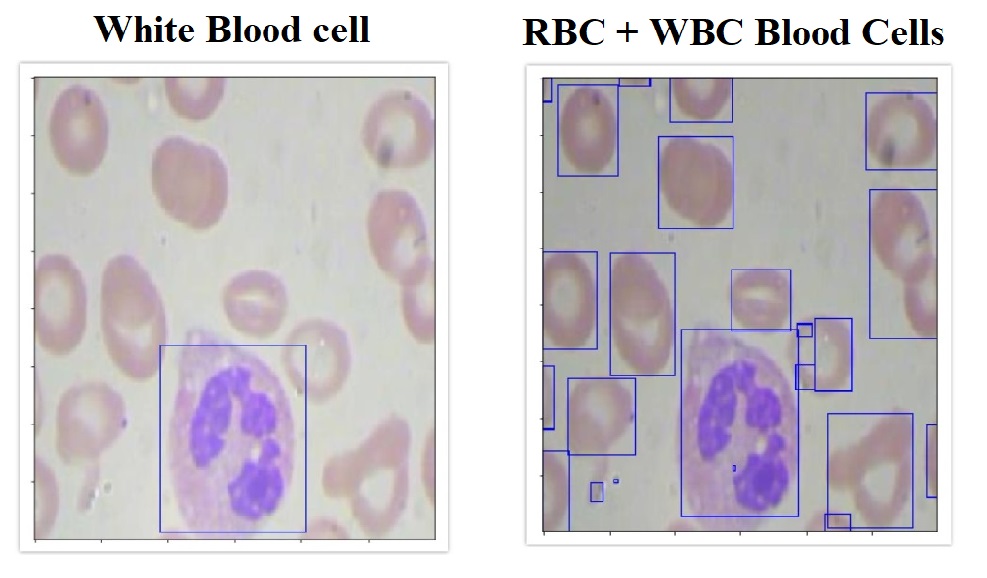 GitHub - omal19/White-Bloodcell-Classification-and-detection