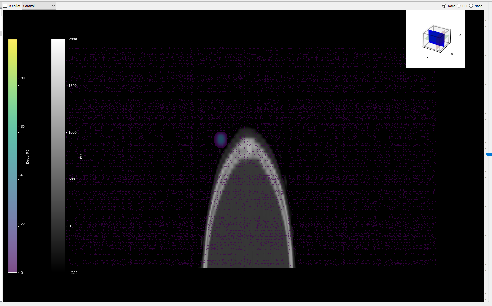 Bug: Sagittal, coronal view doesn't show properly · Issue #413 · pytrip/pytripgui · GitHub