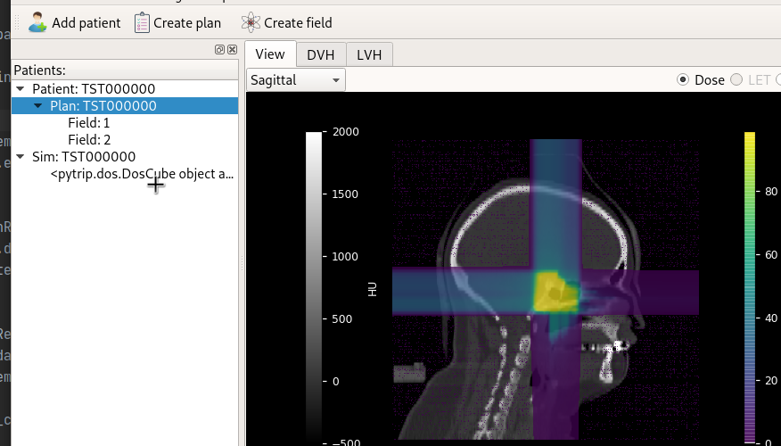 Bug in adding fields to plan. · Issue #327 · pytrip/pytripgui · GitHub