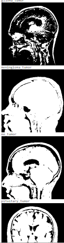 GitHub - devparikh/BrainCancerDetection: This is a project that I made using Tensorflow and ...