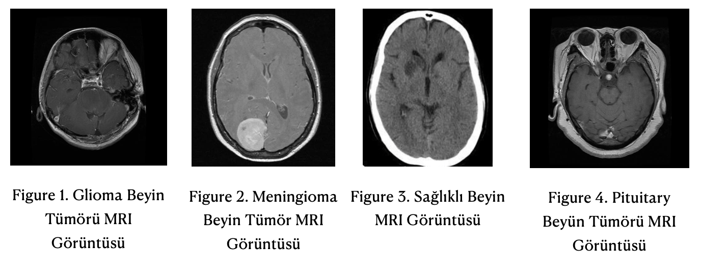 GitHub - OkanBagriacik/Brain-Tumor-Classification-Using-Python