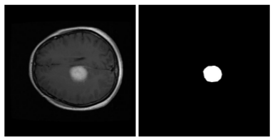 GitHub - MatteoMass/CNN-in-tumor-detection-on-MRI