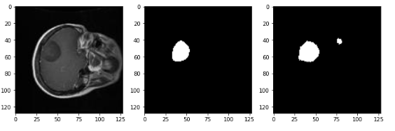GitHub - MatteoMass/CNN-in-tumor-detection-on-MRI