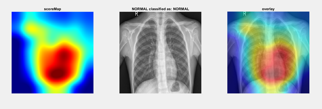 GitHub - JosephRivera1/chestxrayclassification