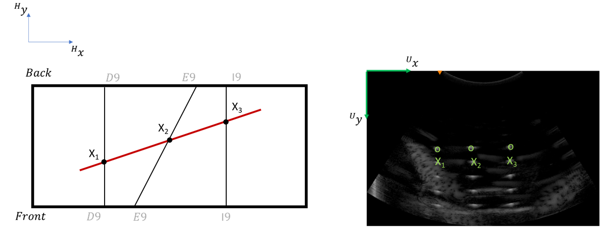 GitHub - mariatirindelli/WirePhantomCalibration: Implemention of the ...