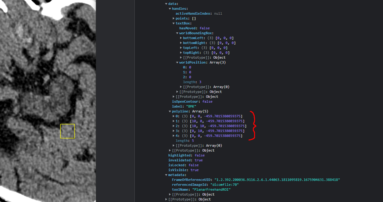 problem with the state in @cornerstone/tools · Issue #426 · cornerstonejs/cornerstone3D · GitHub