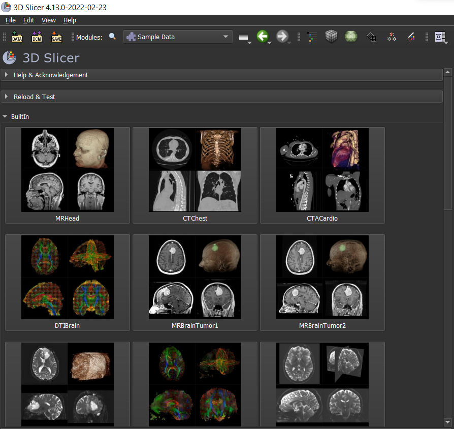 GitHub - ziyunxiao/SlicerVolumePlaneCut: Slicer Extension for Volume ...