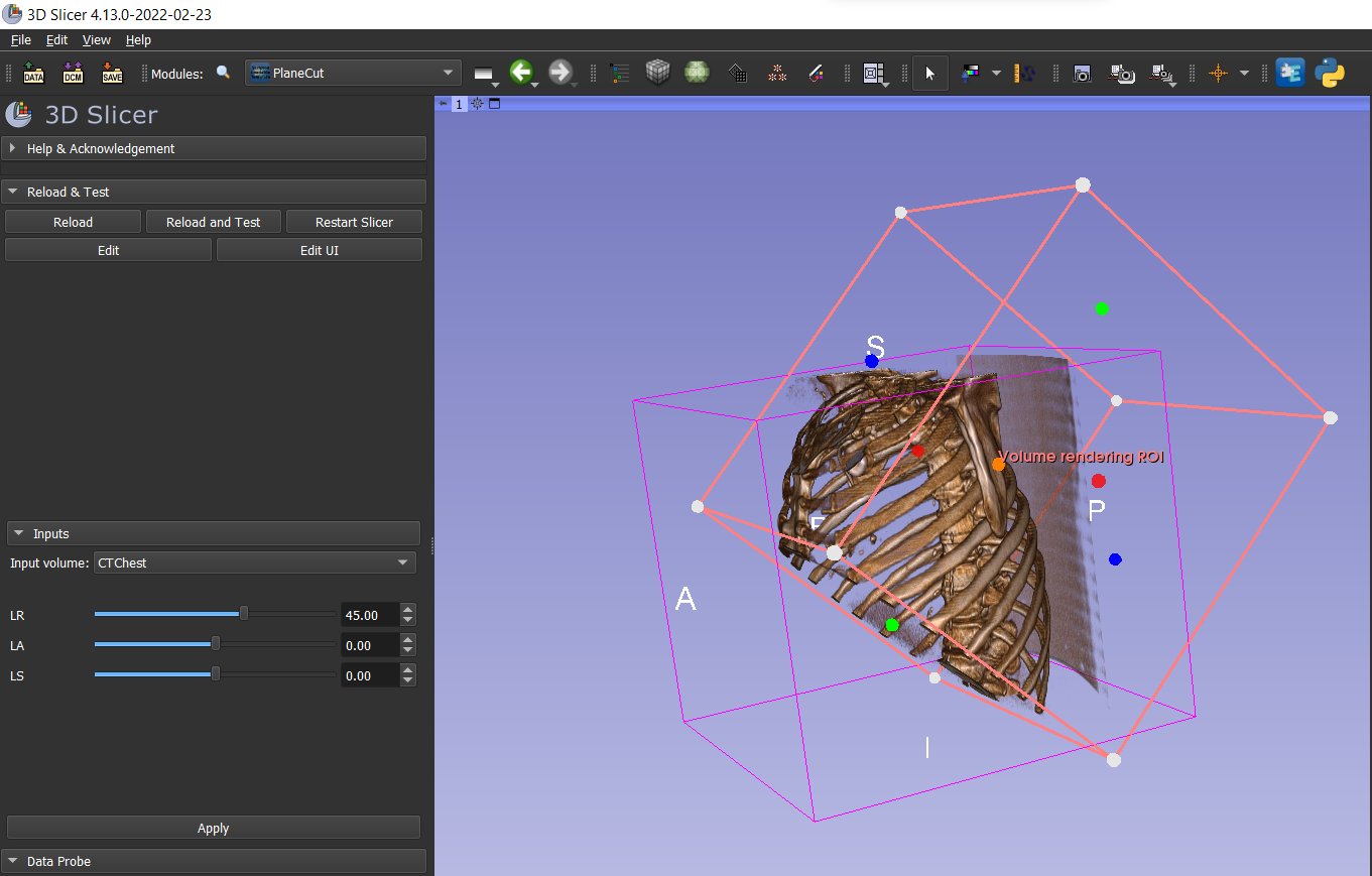 GitHub - ziyunxiao/SlicerVolumePlaneCut: Slicer Extension for Volume ...