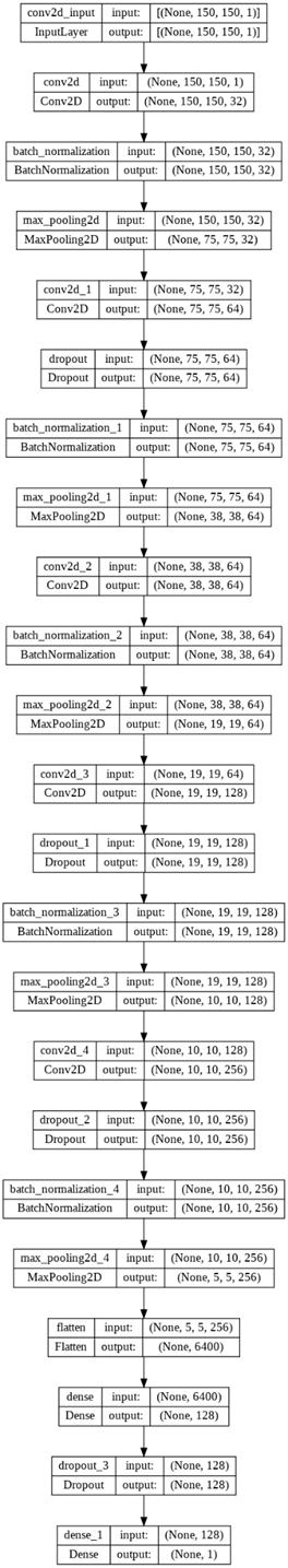 GitHub - Dhruv590/Pneumonia-Detection-on-Chest-Xrays: COEN 281 Final Project