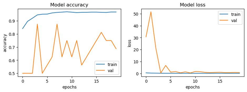 GitHub - Dhruv590/Pneumonia-Detection-on-Chest-Xrays: COEN 281 Final Project