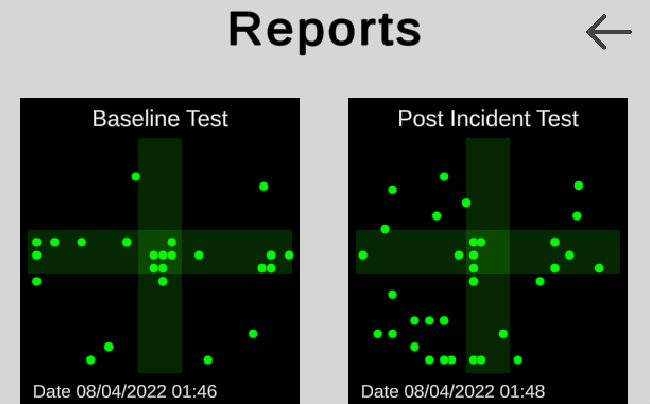 GitHub - Concussion-Detector/Concussion-Detector: Concussion Detecting ...