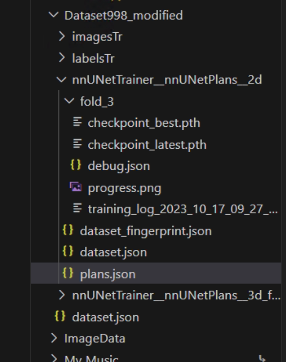 small sclerosis segmentation · Issue #1754 · MIC-DKFZ/nnUNet · GitHub
