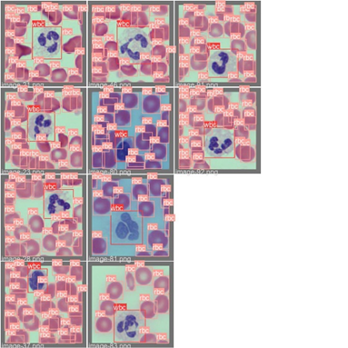 GitHub - BigDoot/BloodCellDetection: Classification of red and white ...