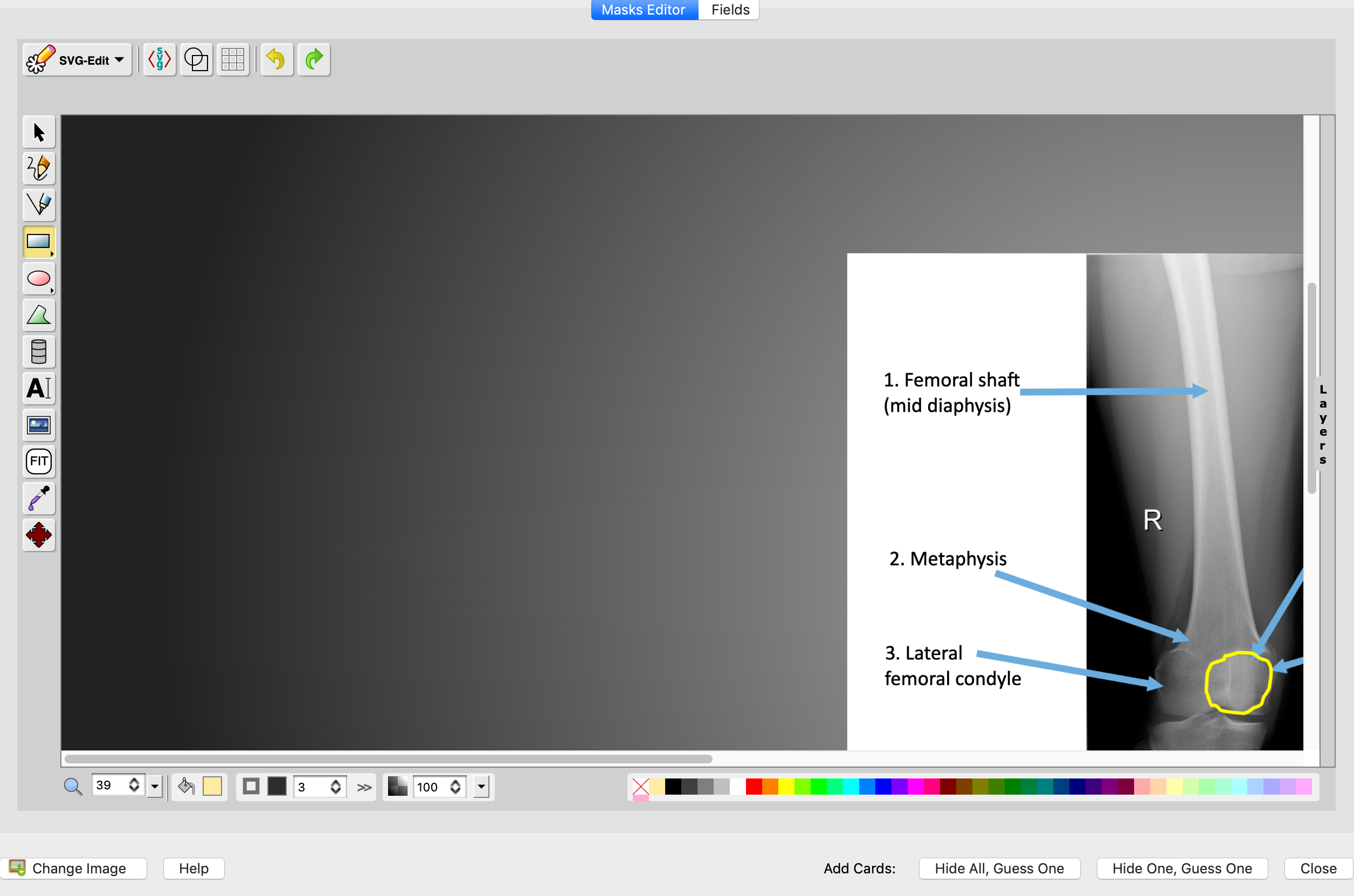 IOE Auto Fit to Canvas Issue · Issue #132 · glutanimate/image-occlusion-enhanced · GitHub