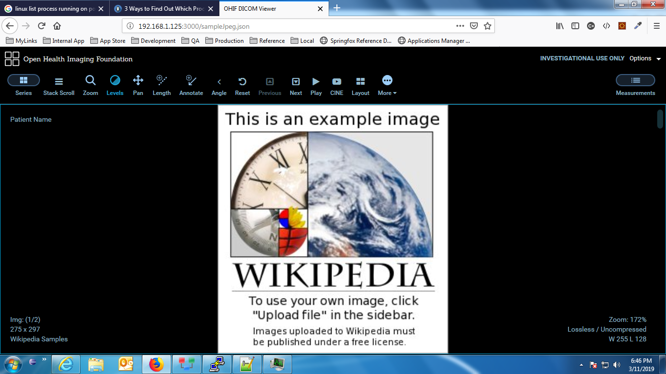 Standalone Viewer Not Working In Ie 11 · Issue 369 · Ohifviewers · Github